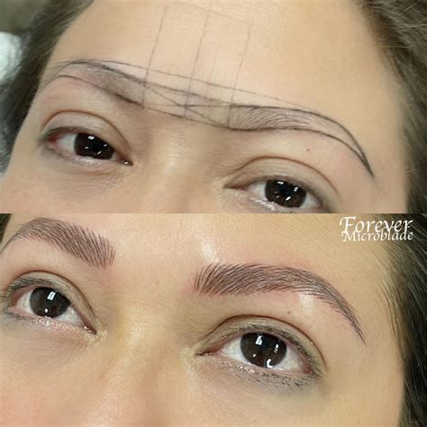 Nanoblading Brows Before And After Forever Microblade