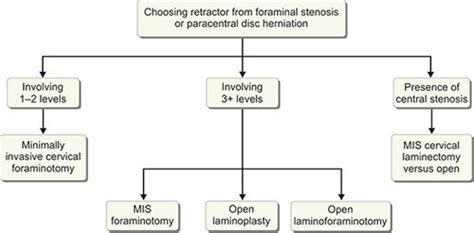 Foraminotomy Vs Laminectomy