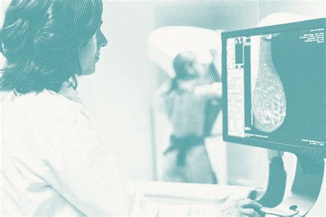 dense breast tissue risks detection and screening options bcrf