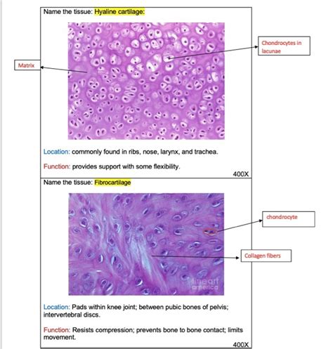 Solved Name The Tissue Simple Columnar Epithelium Nuclei