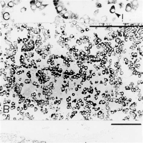 Somatotroph Organization The Relative Proportion Of Individual Download Scientific Diagram