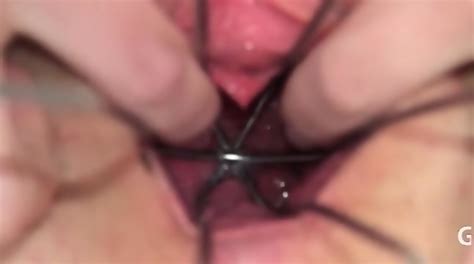 Gyno Gaping Of Beautiful Italian Model Eporner