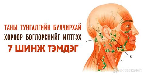 Бие дэх Xopыг гадагшлуулах үүрэгтэй тунгалгийн булчирхай бөглөрсөн байгааг илтгэх 7 шинж тэмдэг