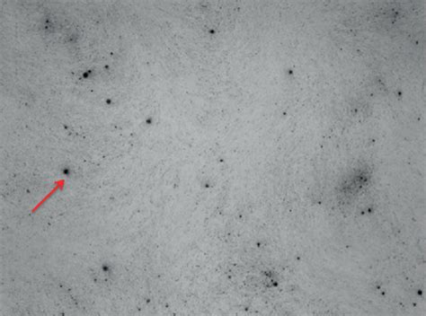 Alizarin Red S Stained Mineralized Nodules After Coculture With