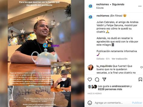 Juli N Cabrales Mostr Por Primera Vez La Herida En Su Cabeza Tras Accidente En Fin De A O Infobae