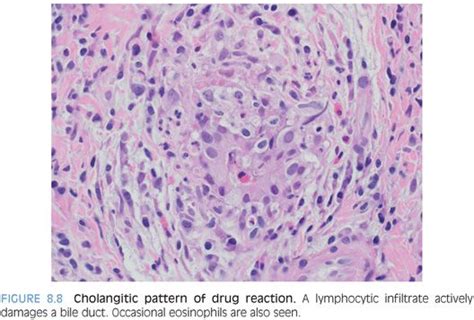 Drug Effects Abdominal Key