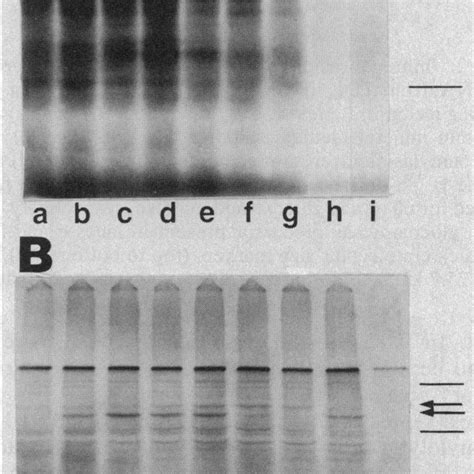 35s Methionine Labeled In Vitro Translation Products Made From Total