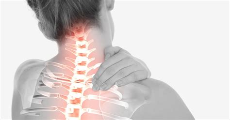 Cervicobrachial Syndrome Definition Symptoms Causestreatment