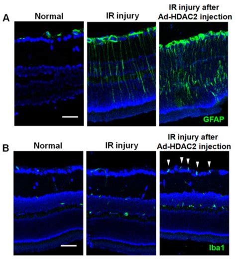 Ijms Free Full Text Hdac2 Regulates Glial Cell Activation In