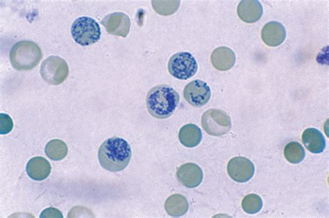 Reticulocytes Using Vital Stain Medical Laboratories