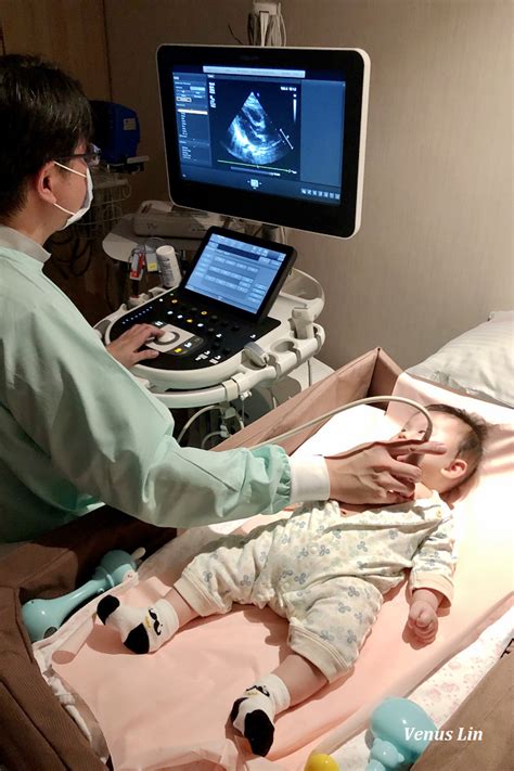 育兒｜4m0d新生兒滿四個月打預防針口服輪狀病毒第二劑心臟超音波追蹤 跟著小v吃喝玩樂