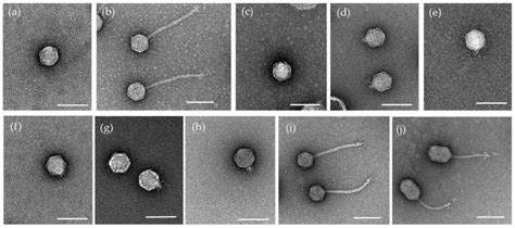 Electron Micrographs Of Isolated Phages Electron Micrographs Of Download Scientific Diagram