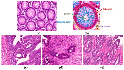 Example Images A Normal Colon Tissue B Detailed Structure Of A Download Scientific