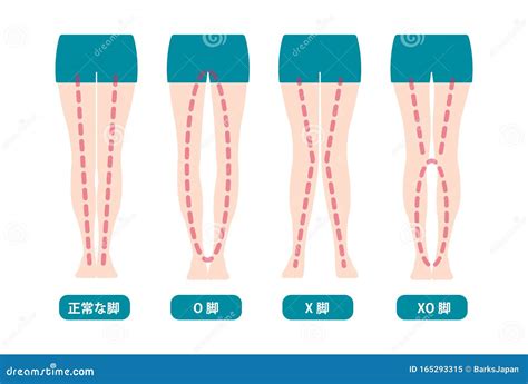 Difference Types Of Legs Angles And Knees Vector Illustration Normal