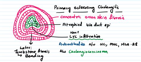 Primary Sclerosing Cholangitis Pathonotes
