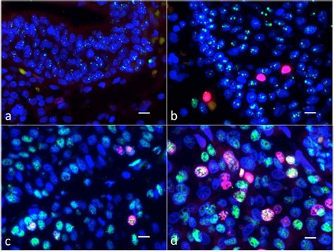 Double Label Immunofluorescent Studies Of P53 Binding Protein 1 53bp1