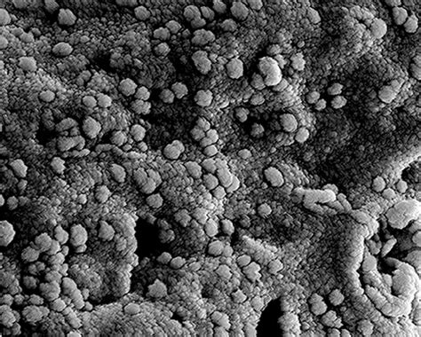 High Performance Electron Microscopy From Milexia