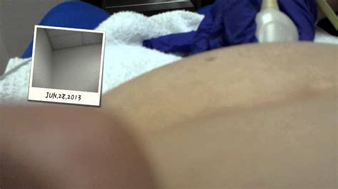 Transvaginal Ultrasound YouTube