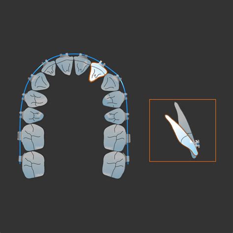 Animation Torque 2 Upper Lateral