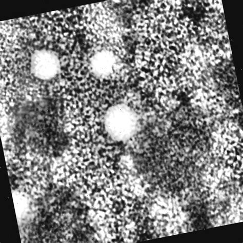 Waterborne Pathogens Detection Object Detection Dataset And Pre Trained Model By Pratham