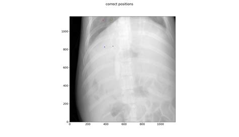 Unexpected Drr Orientation · Issue 99 · Arcadelab Deepdrr · Github