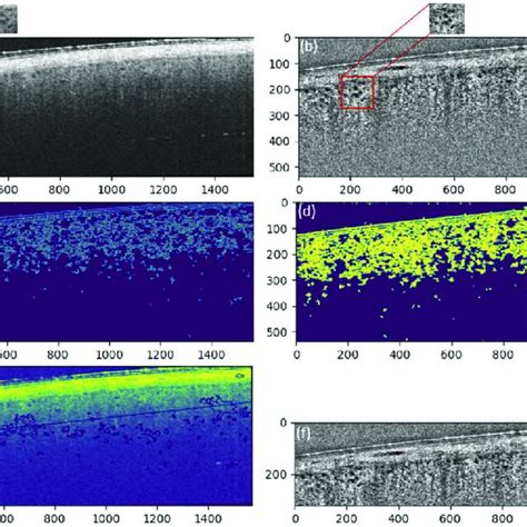 Block Diagram Of The Proposed Residual Attention Unet Segmentation