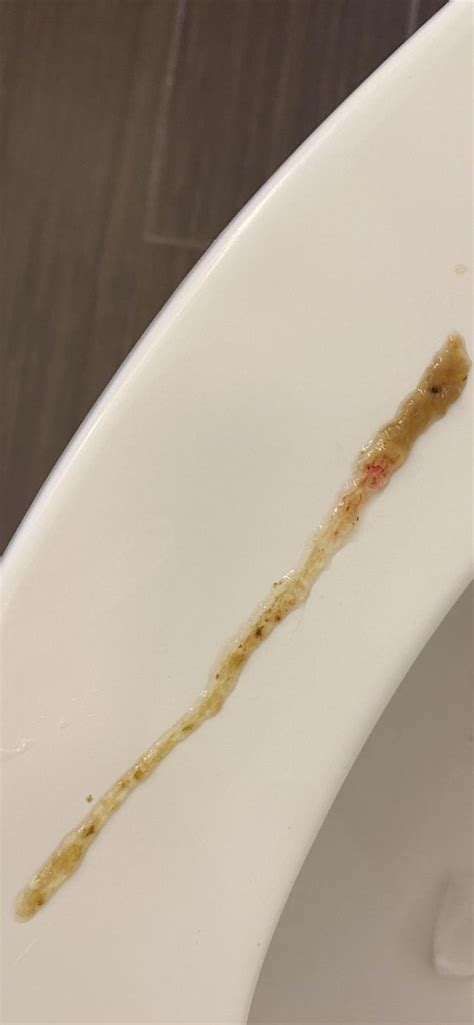 Trigger Warning Stool Photo R Toxicmoldexposure