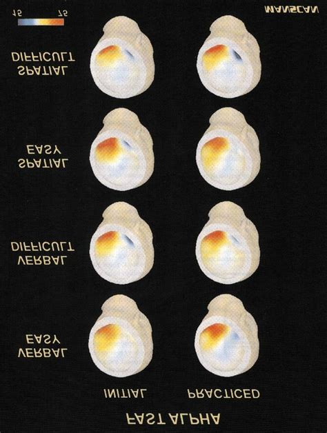 High Resolution Eeg Topographic Maps Showing The Deblurred Topography Download Scientific