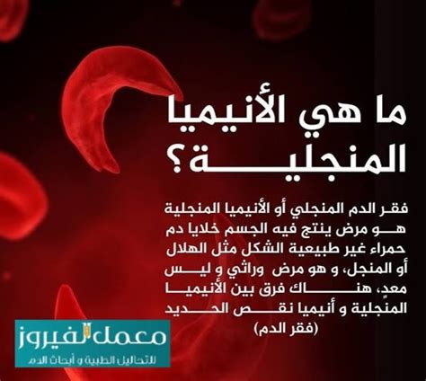 معمل الفيروز للتحاليل الطبيه ️⃣ الأنيميا المنجليه ️⃣ ⬅️ نبذة مختصرة