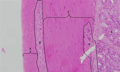Nerve Plexi And Spinal Cord