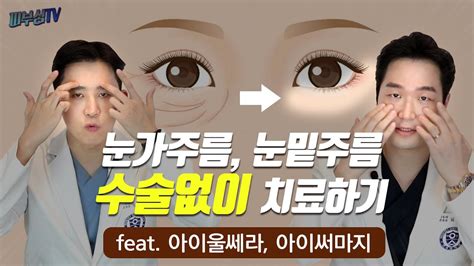 눈가 주름 눈밑 주름을 수술없이 치료하기 Feat 아이울쎄라 아이써마지 [피부과전문의 피부심] Youtube