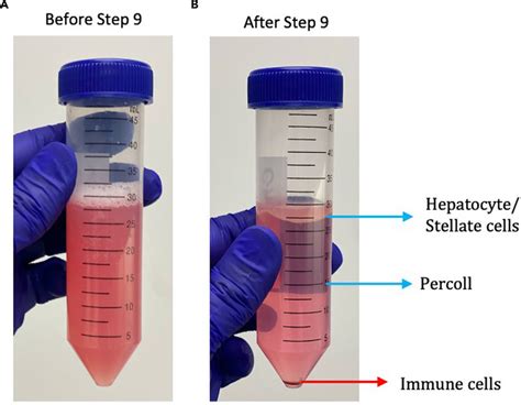 Setup Of The Percoll Density Gradient A An Example Of A Prepared Download Scientific Diagram