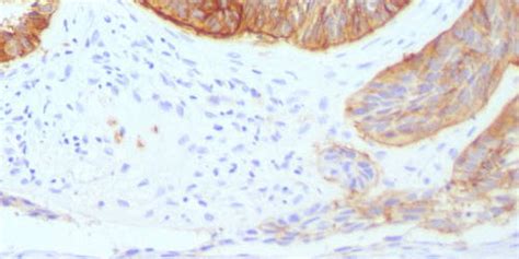 Ihc Products