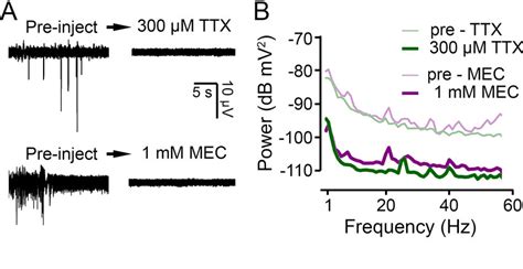 Pharmacological Suppression Of The Lfp Signal A Lfp Traces Before