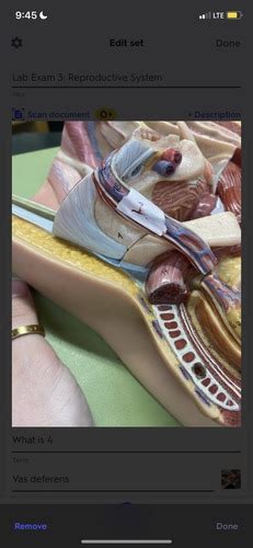 Lab Exam Reproductive System Flashcards Quizlet