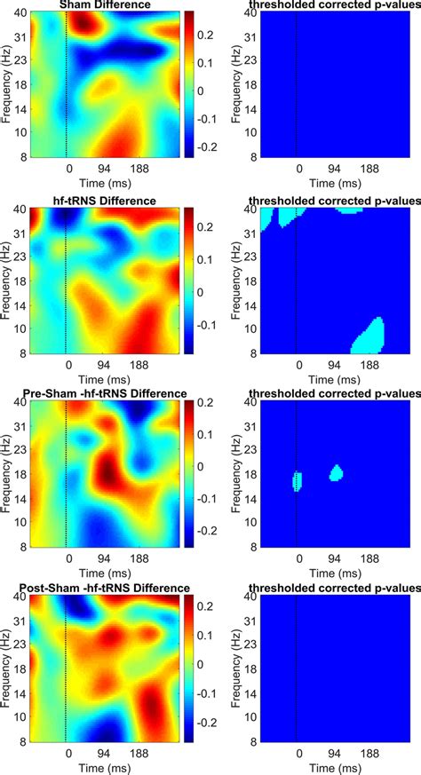 Difference In Ersp In Db Between Pre And Post Stimulation Eeg For Download Scientific
