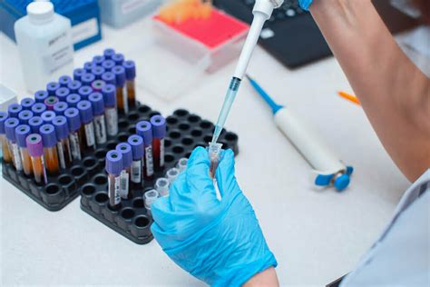Learn About Thyroid Disease Symptoms And Thyroid Testing
