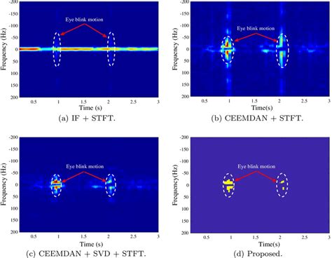 Time Frequency Spectrum With Eye Blink Twice Download Scientific Diagram