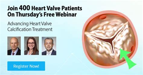 Adam Picks Heart Valve Surgery Blog For Patients