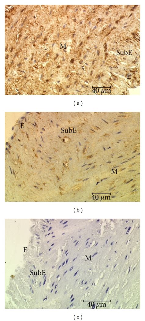 Expression Of The Bax In The Endothelium E Subendothelial Layer Download Scientific Diagram