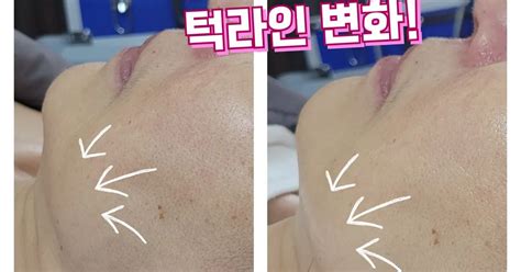 리프팅관리 올가드림뷰티 동산점 숨고 숨은고수