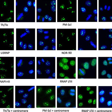 Immunofluorescence Antinuclear Antibodies Hep 2 Ana Slides Mbl Inc