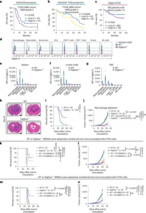 Siglec9⁺ Macrophages Are Associated With Poor Clinical Outcome And