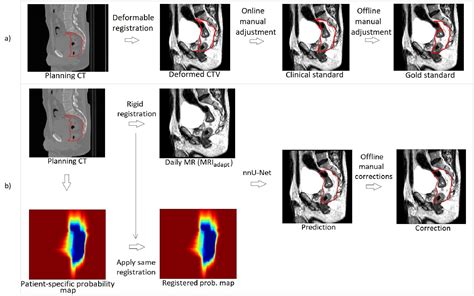 Evaluation Of Deep Learning Clinical Target Volumes Auto Contouring For