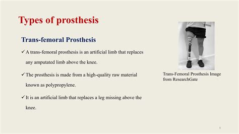 Limb Prosthetic Types Of Limb Prosthetic Ppt