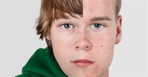 Puberty Medical Exam Prep