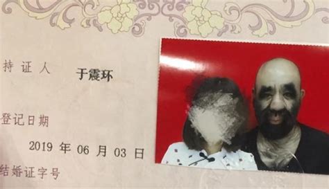 轟動一時「毛孩」于震寰，娶90後嬌妻堅持生子，如今孩子還好嗎？ 每日頭條