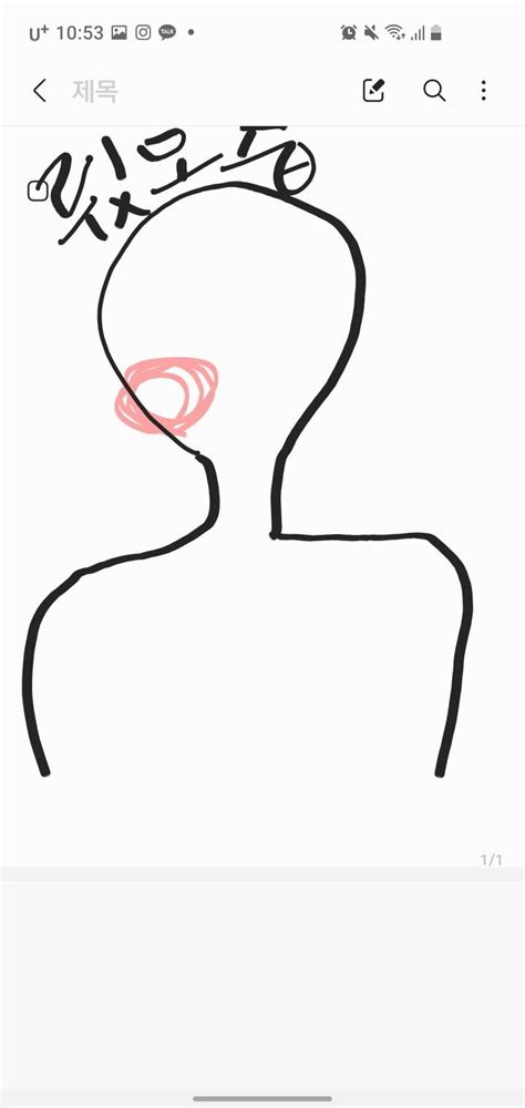나 이거 병원 가봐야하나 인스티즈instiz 일상 카테고리