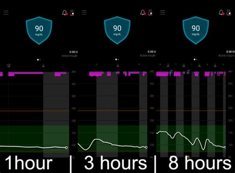 Understanding Your CGM Data The Ups Downs And Realistic Expectations Of Diabetes Management