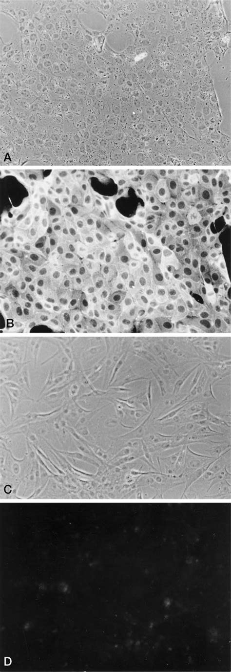 Indirect Immunofluorescence Staining Of Mock Transfected And